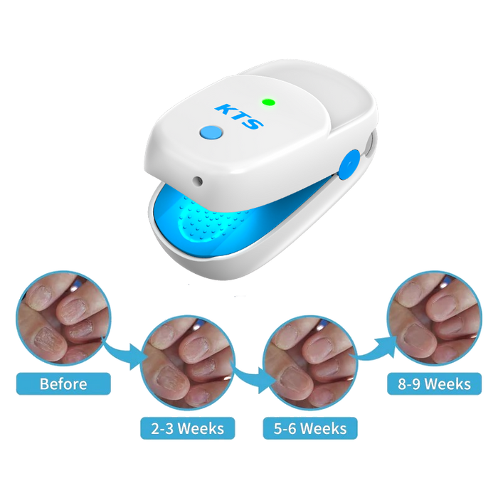 KTS® Australia | Leading Light & Laser Therapy Solutions
